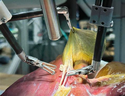 Are Autonomous Surgeons The Future A Deep Dive By Avin Sharma By