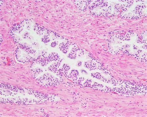 Fileprostate Histology 05 Embryology