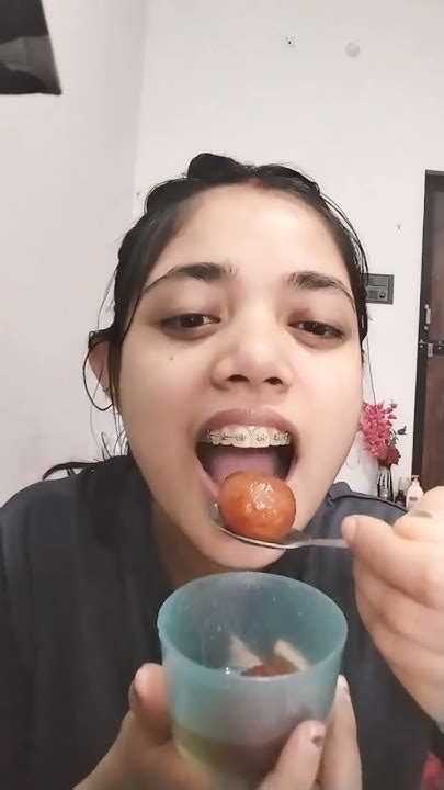 Day 24365 Journey Of Braces 😬 Braces Trending Viral Shorts Youtube