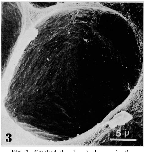 Figure 3 From Scanning Electron Microscopy Of Calcification Of Cartilage Matrix In The