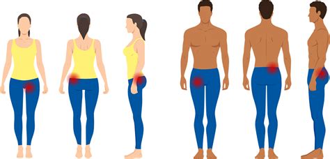 How To Identify The Severity Of Your Hip Pain Core Orthopedics