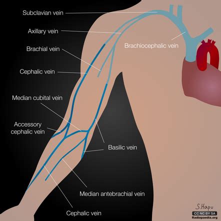 Distal Basilic Vein Location Basilic Vein Arm Vcog