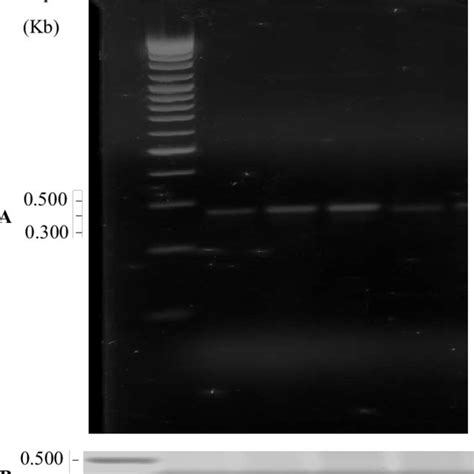 Rt Pcr Amplification Of Copia Like Elements Under Sorbitol Stress Using Download Scientific