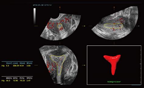 Asset Download Mindray