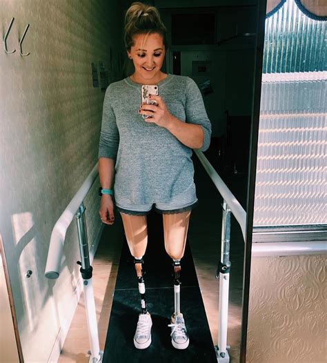 Pin By Tracey Webb On Prosthetic Legs Amputee Model Woman Disabled