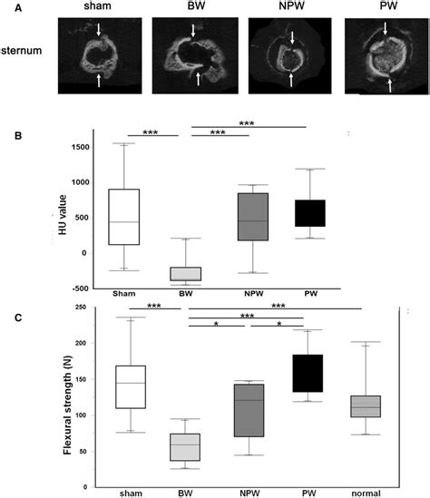 Sternum At 2 Weeks After Surgery A Representative Micro Computed Download Scientific Diagram