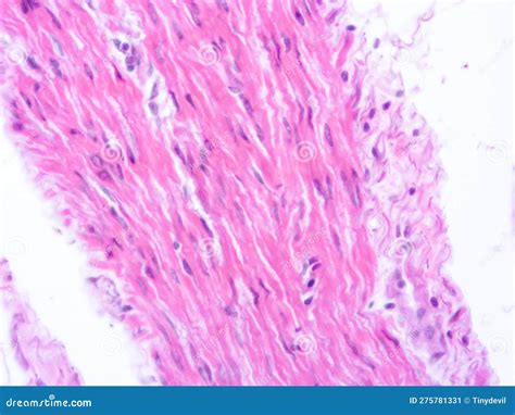 Histology Of Human Appendix Micrograph Showing Crypts Of Lieberkuhn Royalty Free Stock