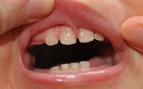 Maamuu · Уруулын дээд хөвч богино бол үүдэн шүд завсартай ургадаг