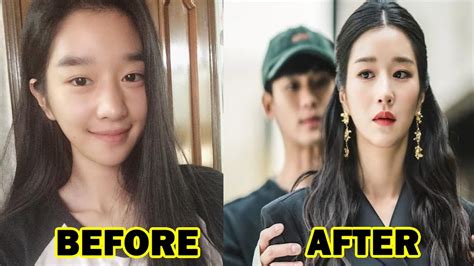Korean Media Has Revealed The Evidence Of Seo Ye Ji Plastic Surgery