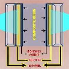 Incremental Layering Techniques Download Scientific Diagram