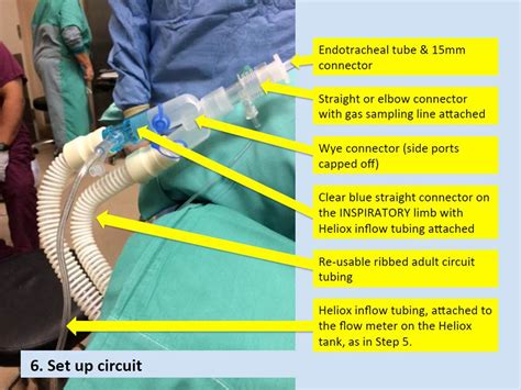 Heliox Setup For The Difficult Airway Iowa Head And Neck Protocols