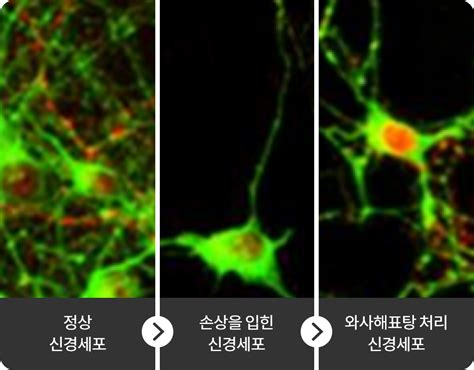 안면신경마비 자생 치료의 모든 것 자생한방병원
