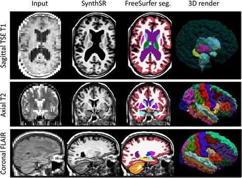 Pengolahan Citra Medis Menggunakan Matlab Pemrograman Matlab