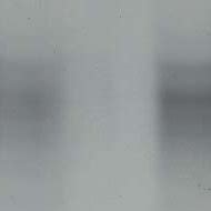 3 Examples Of Band Patterns Resulting From Different SSR Primer Pairs Download Scientific