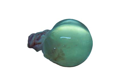 Echinococcus Igg Test Dydatid Cyst At ₹2499 Healthcare Nt Sickcare