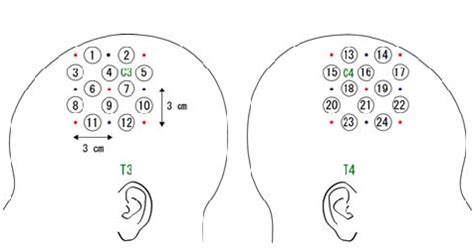 Arrangement Of Measurement Channels Over Left And Right Sensorimotor Download Scientific