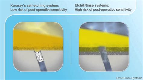 Self Etching Vs Filler Primer At Donald Altman Blog