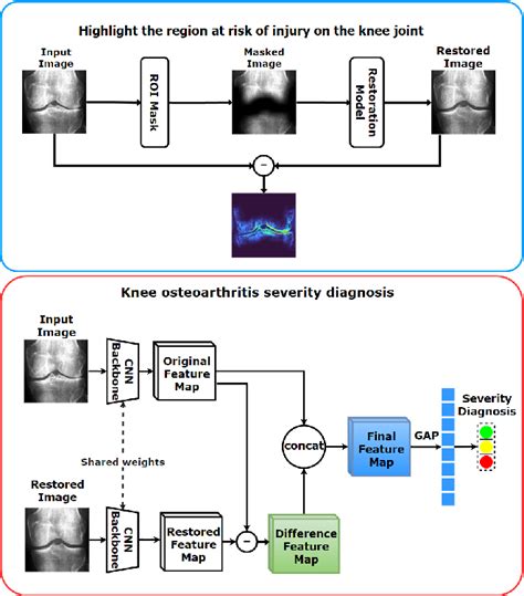 Figure 2 From Osteoga An Explainable Ai Framework For Knee Osteoarthritis Severity Assessment