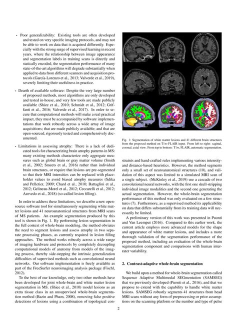 A Contrast Adaptive Method For Simultaneous Whole Brain And Lesion Segmentation In Multiple
