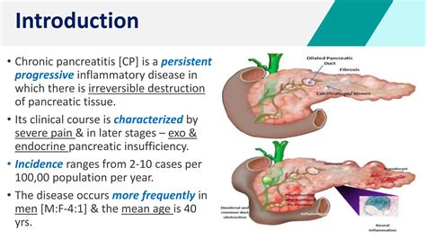 Pancreatitis Acute And Chronic Types C F And Mgt Pdf
