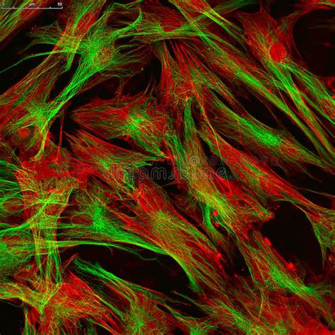 Dna高清图片 用荧光染料标记成纤维细胞（皮肤细胞） 用荧光染料标记成纤维细胞（皮肤细胞）图片免费下载 5127665472 千图网pro