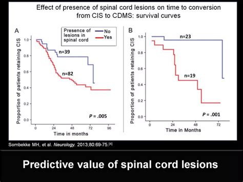 Clinically Isolated Syndrome And Clinically Definite Multiple Sclerosis