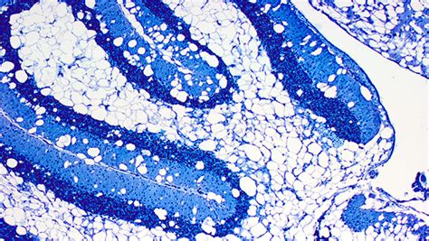 Does Axon Initial Segment Plasticity Regulate Neuron Excitability