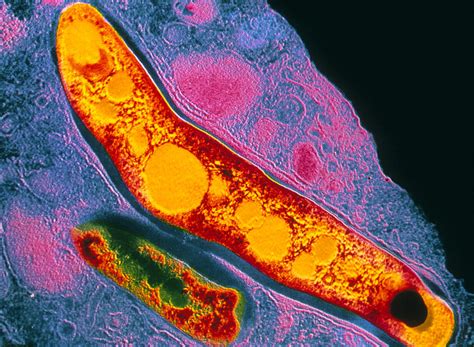 Mycobacterium Tuberculosis Bacterium By Science Photo Library