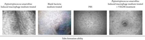 The Effect Of Peptostreptococcus Anaerobius Upon Tube Formation For Download Scientific Diagram