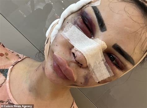 Surgery Addict Spends To Change Her Kim Kardashian Look Daily Mail Online