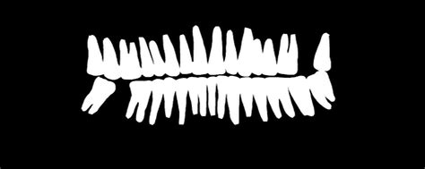 SerdarHelli SegmentationOfTeethPanoramicXRayImages Datasets At Hugging Face