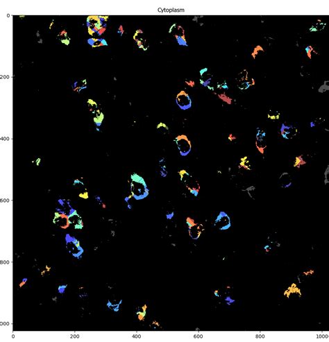 pls help quantifying number of puncta in cytoplasm can t quite get