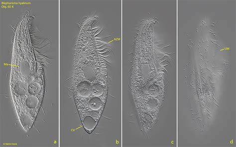 Blepharisma Hyalinum Real Micro Life