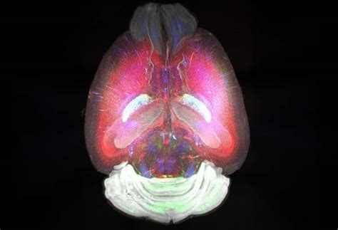 3d Rna Imaging Revolutionizes Brain Research Neuroscience News