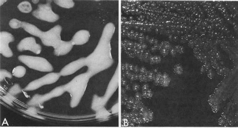 Mucoid Colony Cryptococcus Mycology University Of Adelaide