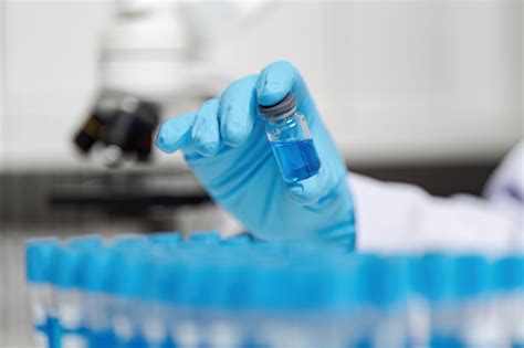 과학 연구 및 실험을 위해 현미경을 배경으로 실험실 바이알에 파란색 액체를 들고 있는 과학자 Stem 주제에 대한 스톡 사진 및 기타 이미지 Istock