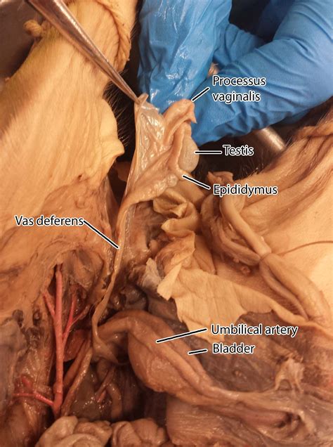 Reproductive System Dissection Photos