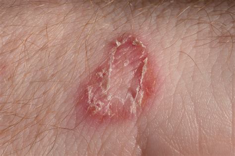 Infectious Disease Topics Healthify