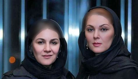 تغییرات چهره ای لاله اسکندری از گذشته تا به امروز بیوگرافی و عکس لباس