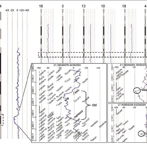 Array Based Cgh Data Showing Deletions Between Erg And Tmprss2 In