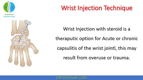 Wrist Injection Technique 2023 Artofit