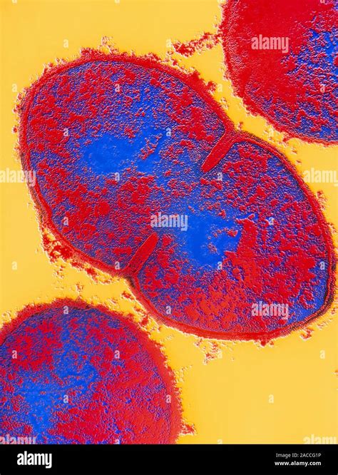 Resistant Streptococcus Strain Coloured Transmission Electron