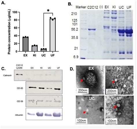 News In Proteomics Research How Do Different Methods For Enriching Extracellular Vesicles From