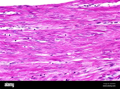 Normal Uterus Wall Light Micrograph Of A Section Through The Middle
