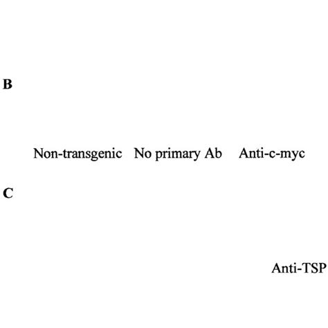 Tsp Expression In Rac V12 Transgenic Mice A Rt Pcr Analysis Of Mrna