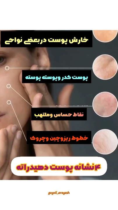 چطوریه آدم بفهمه پوستش کم آبه؟روتینپوستی دخترپسر Youtube