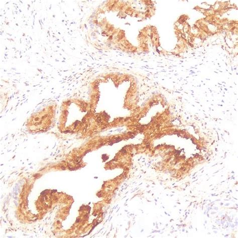 Galectin 3供应商生产厂家 厦门通灵生物医药科技股份有限公司