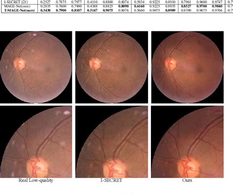 Bridging Synthetic And Real Images A Transferable And Multiple Consistency Aided Fundus Image