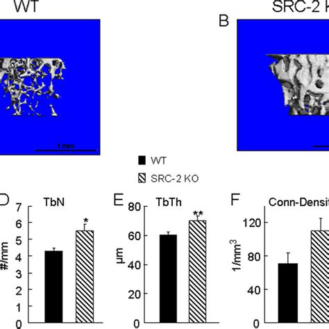 A And B Three Dimensional Trabecular Bone Architecture Of The Proximal