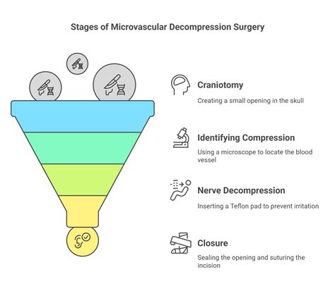 What Is Microvascular Decompression Mytrigeminalneuralgia